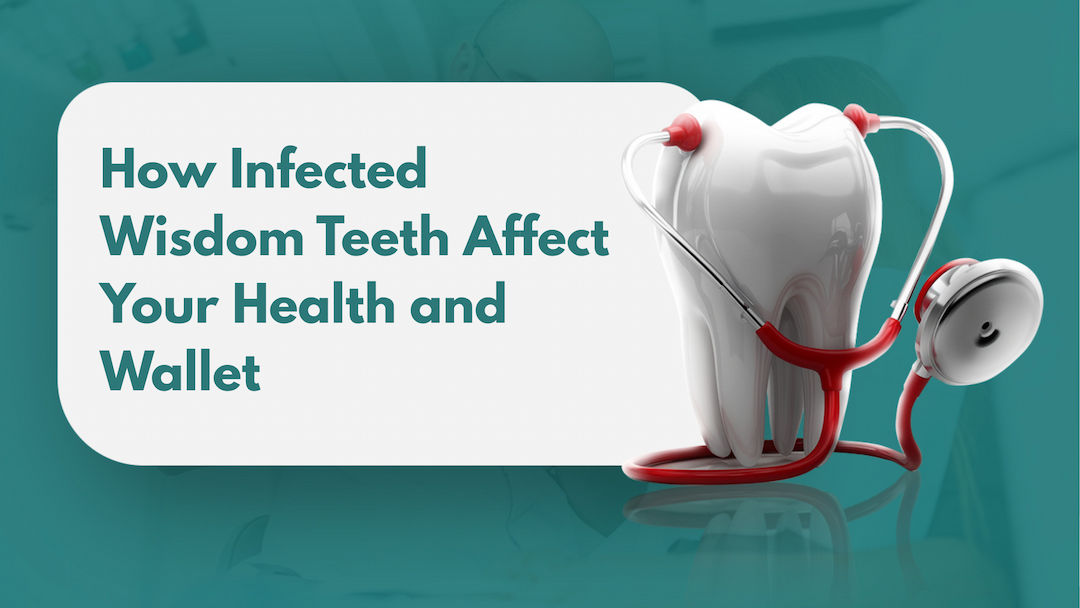 How Infected Wisdom Teeth Impact Your Health and Finances